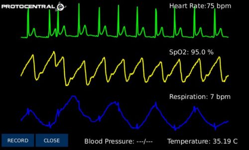 HealthyPi v3 - The Open Source Vital Sign Monitoring HAT for Raspberry Pi - Open-Electronics