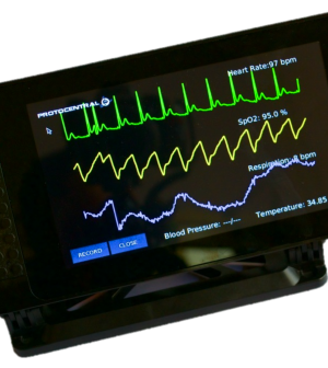 Tag Archive for "cloud" - Open Electronics