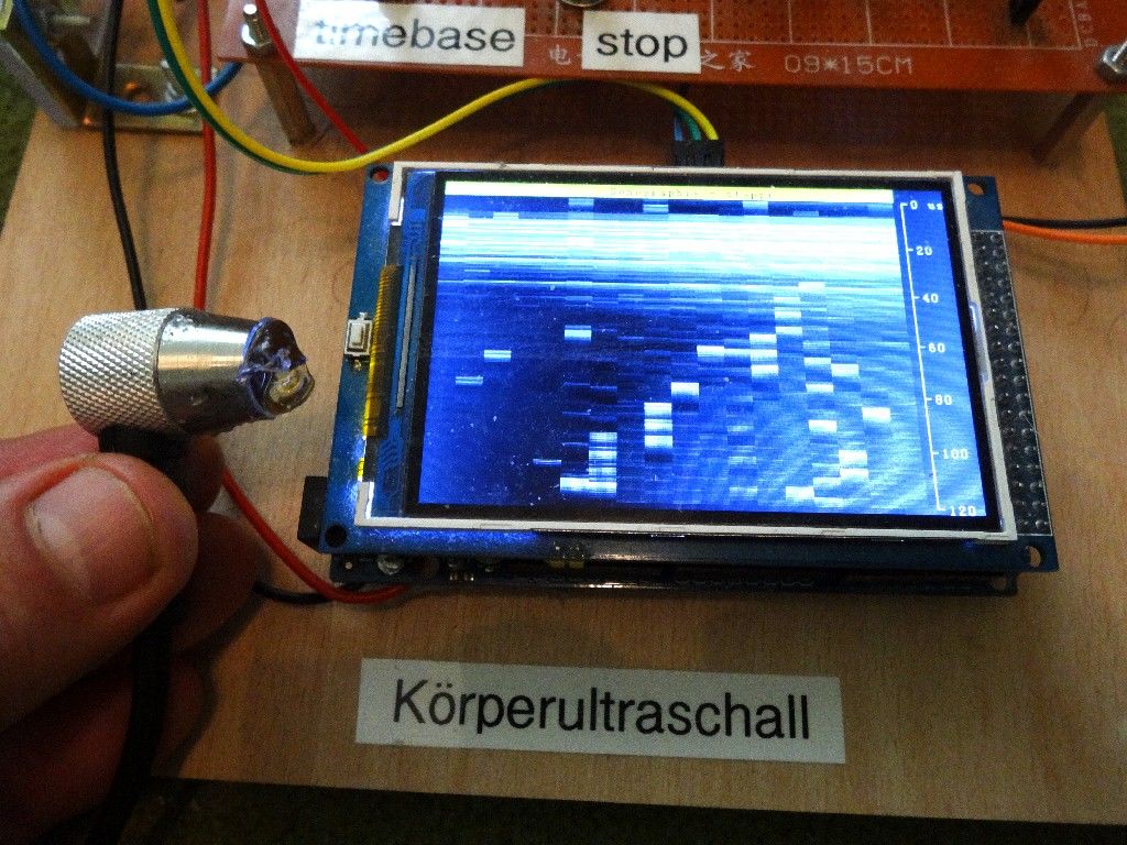 Arduino Sonography Arduino Based Ultrasound Machine Open Electronics Open Electronics